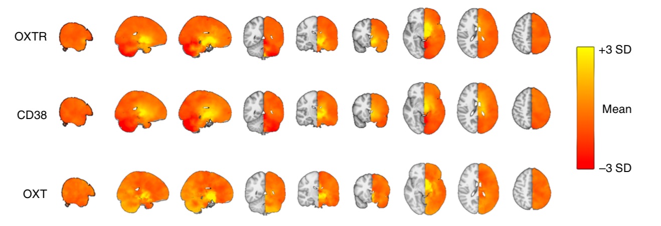 Oxytocin pathway gene networks in the human brain | Daniel S. Quintana